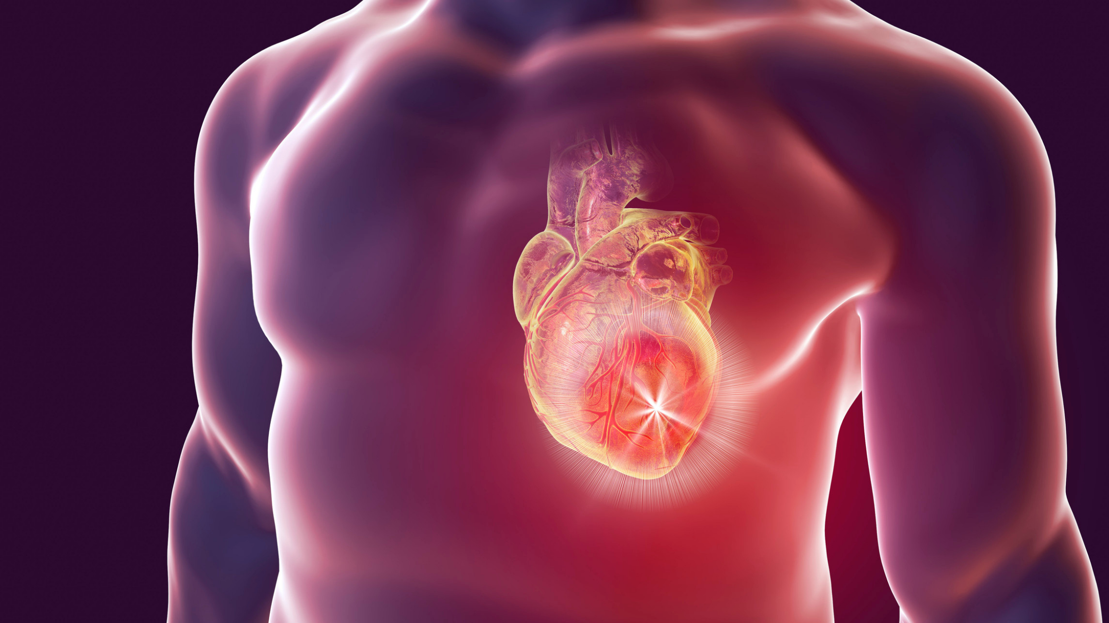 L’infarctus silencieux : un silence qui en dit long (IRM Cardiaque)